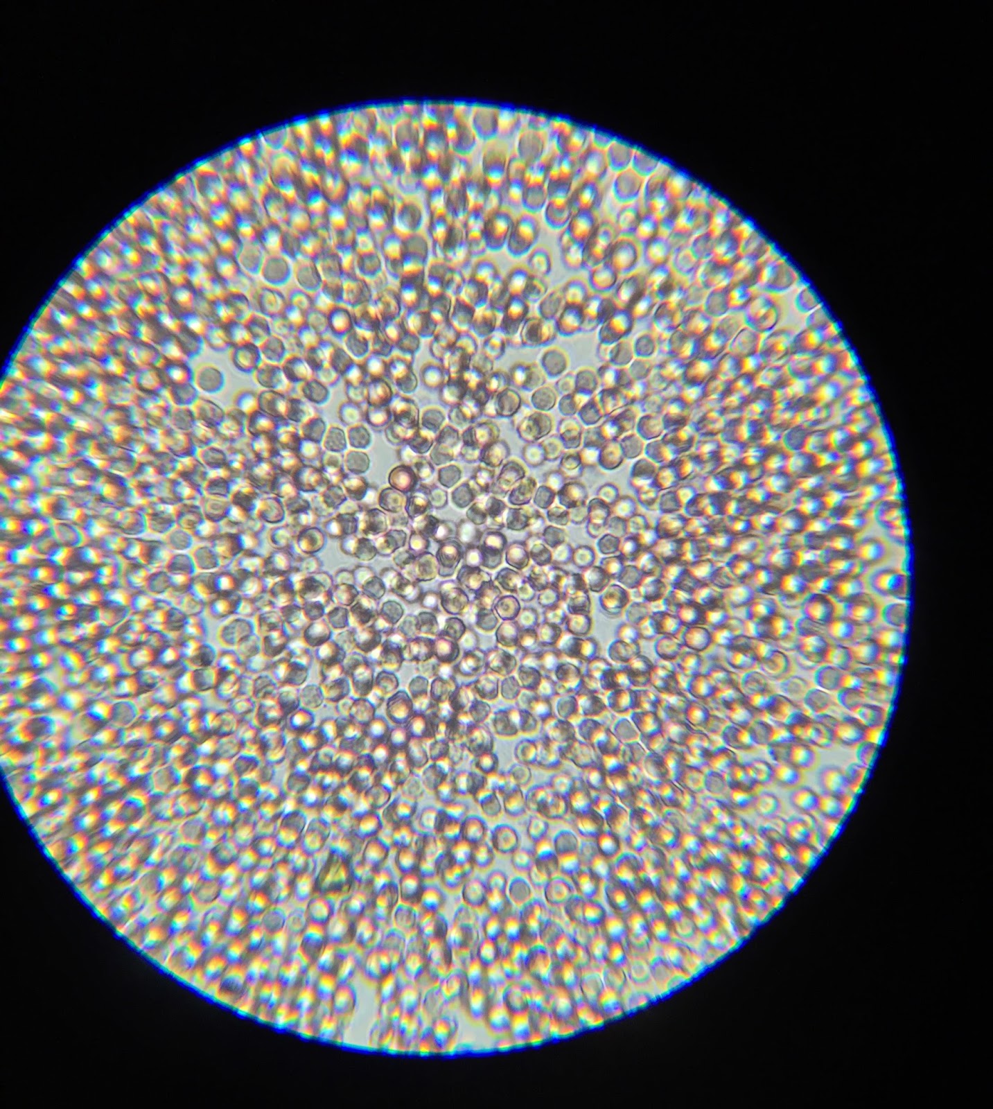 Blood Cells Under Microscope Labeled at Harlan Johns blog