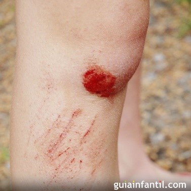 Seguridad, Salud y Bienestar: PRIMEROS AUXILIOS EN LA ESCUELA