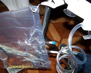 DIALISIS: DIALISIS PERITONEAL