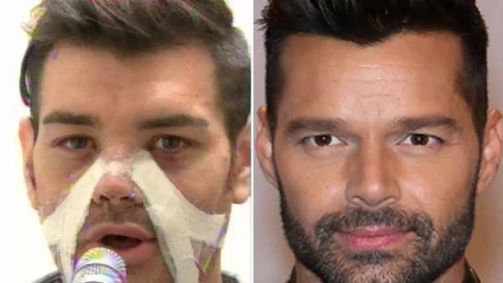 Amor y Moda para ti: ¡Increíble! Se hizo 9 cirugías para parecerse a ...