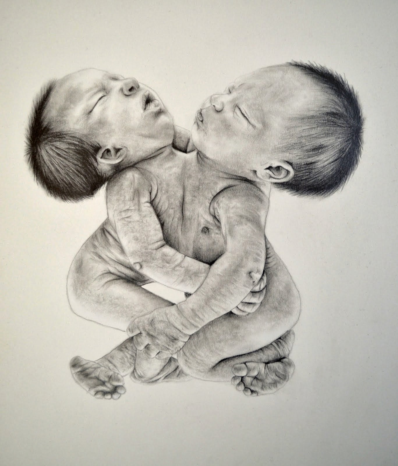 Mónica Silva Tovar - Siameses humanos