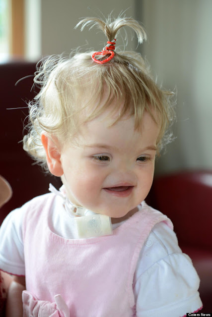 Baby Born Without Nose Is Very Cute Pictures Going Viral - Style Hunt World