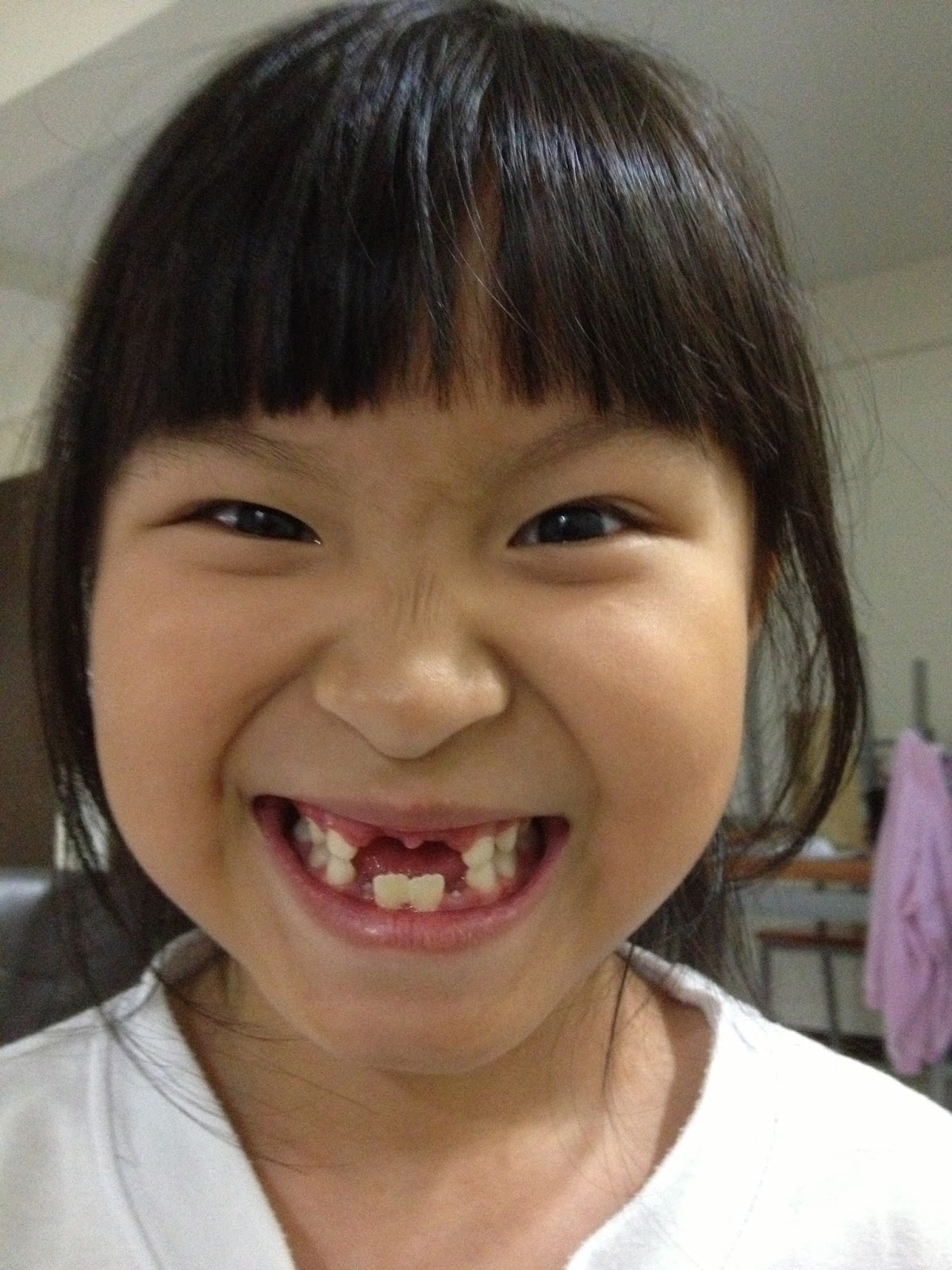 Kaelyn Lee Yi Xuan: Milk Teeth Eruptions