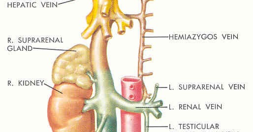 Pedi cardiology: Anomalies of Inferior Vena Cava