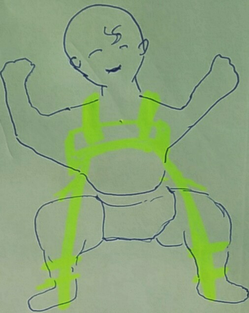 Ortho Image MCQs (Undergraduate level): image Q. 101 - Harness blues