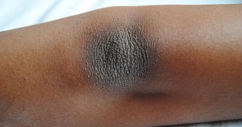 TOZALI: 7 EFFECTIVE WAYS TO GET RID OF DARK ELBOWS AND KNEES.