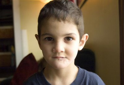 Congenital Insensitivity to Pain with Anhidrosis