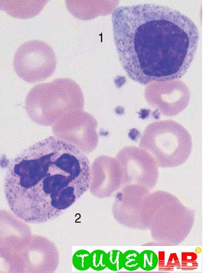 [Haematology] Normal Cells of the Blood and Hematopoietic Organs | Free ...