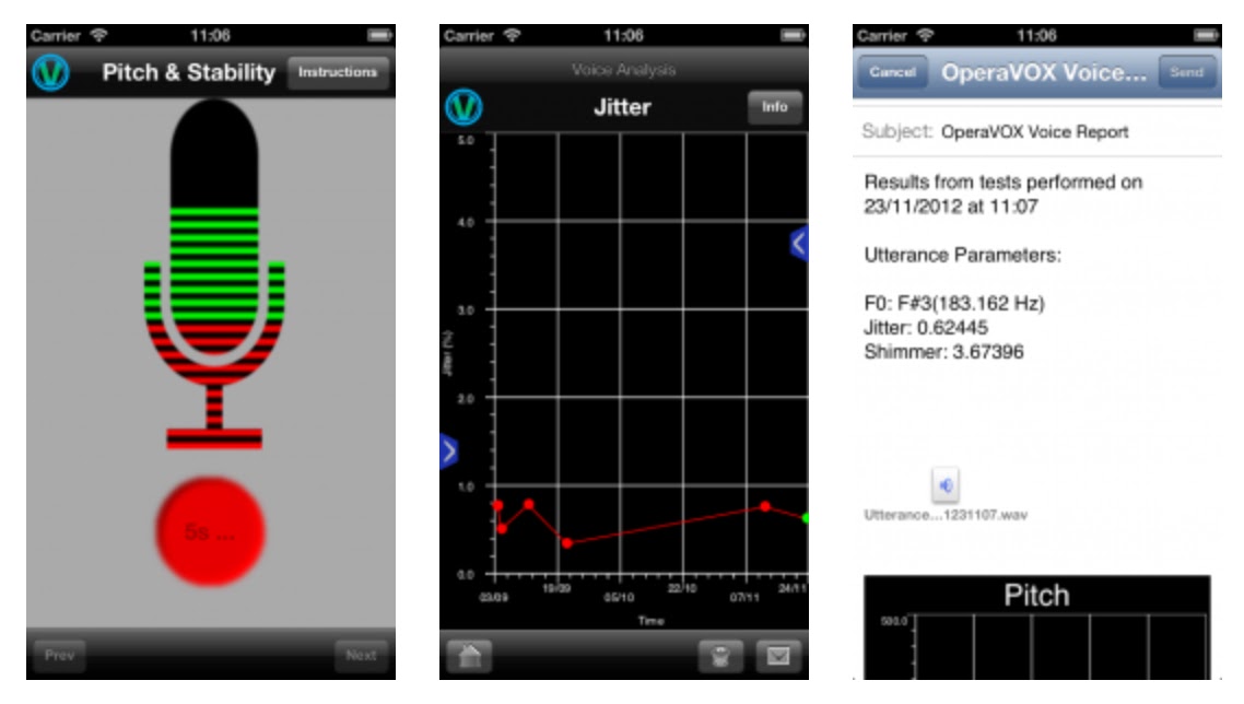 iPhone App to Objectively Measure Vocal Quality (f0, shimmer, jitter ...