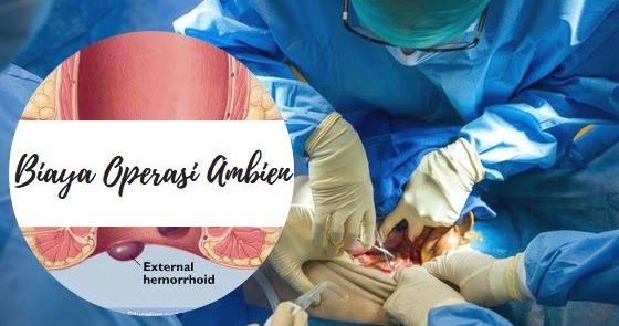 Waspadai Biaya Operasi Ambeien terus meningkat setiap tahunnya - obat herbal wasir