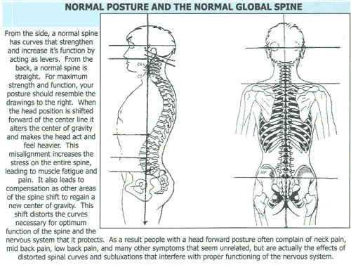 Postural Analysis ~ ARTIKEL FISIOTERAPI