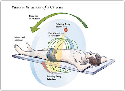 Learning to Live With Who You Are When Diagnosed With Terminal Cancer ...