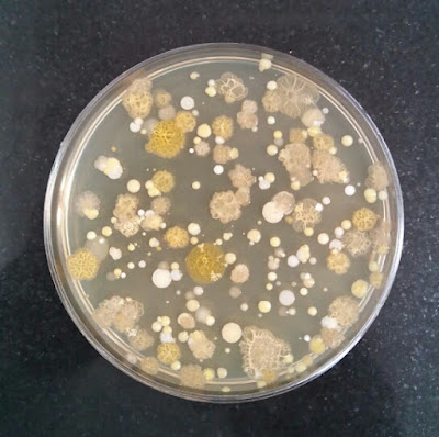 Microbiology Solutions: Selection of incubation conditions for ...