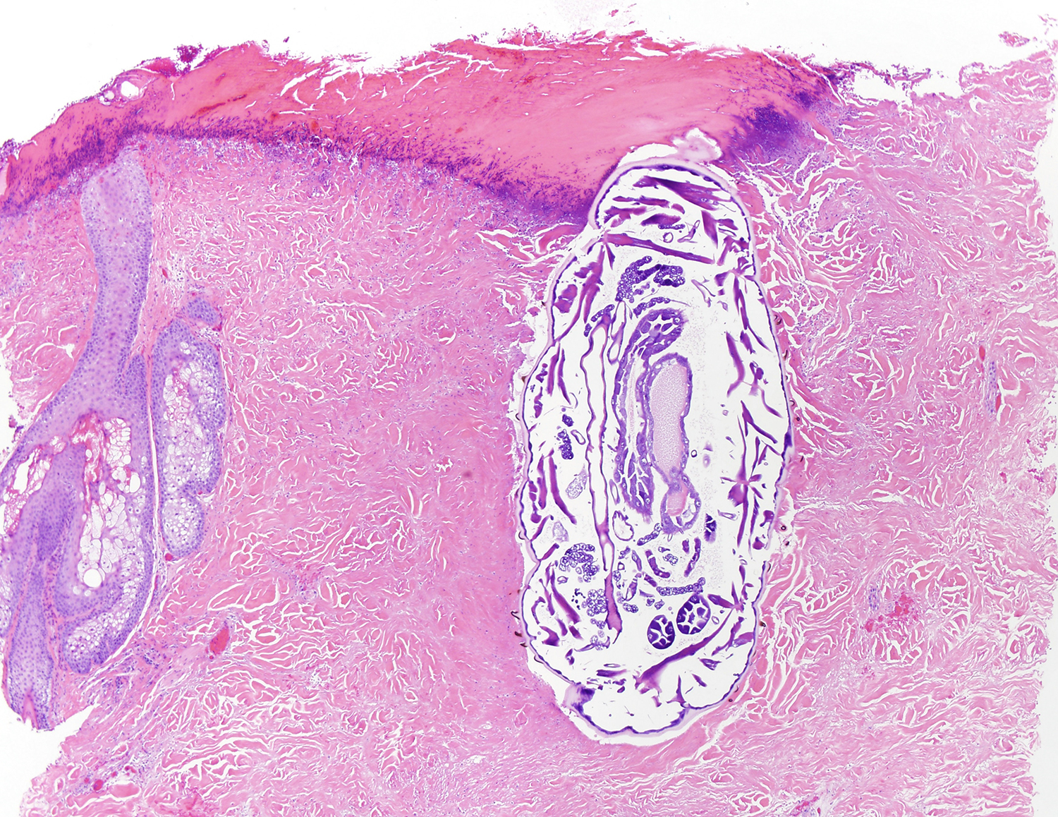 Creepy Dreadful Wonderful Parasites: Case of the Week 528