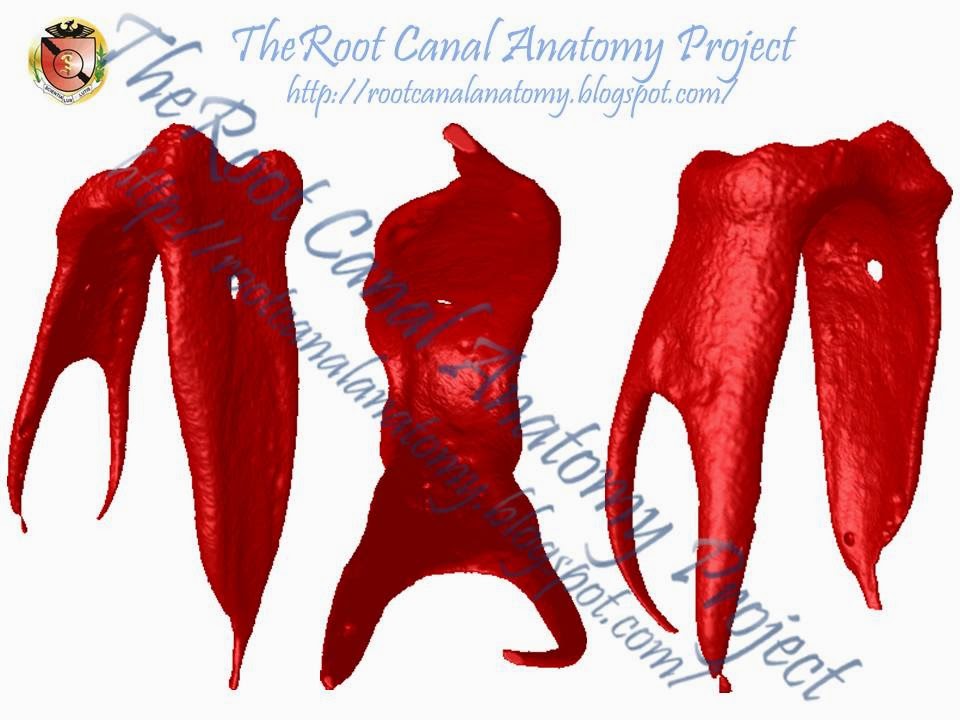 The Root Canal Anatomy Project: Mandibular Second Molar