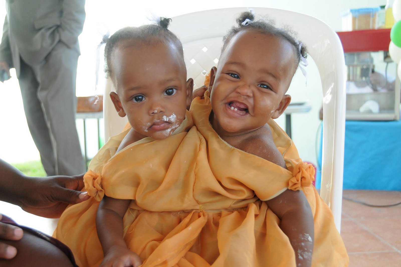 Las siamesas celebran su primer año