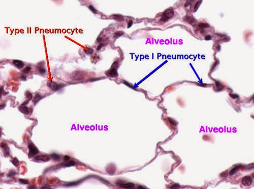 Pneumocytes