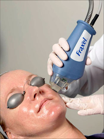 Laser Para Cicatrices - Visita y anota este sitio web con BoosterSite.es