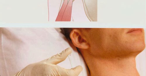 Long Head of Biceps Injection ~ Nursing