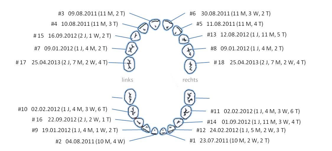 Isn Ding wa??: Zahn # 17 & 18 ... und Kindermund
