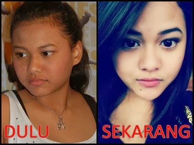 Perbedaan Aurel Hermansyah Dulu dan Sekarang - Pecopas