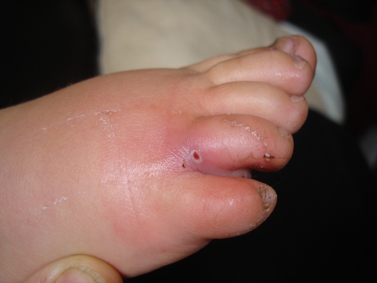 Under African Skies: Theo's Mango Fly