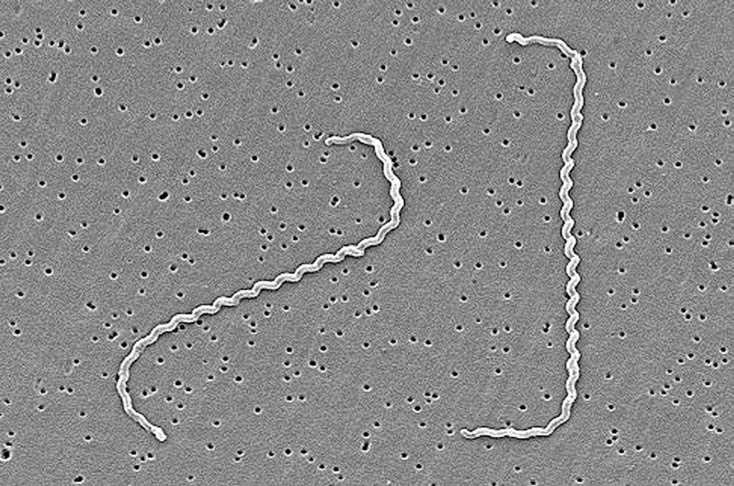 Spirochetes and Bacteria without a Cell Wall | Tuyenlab