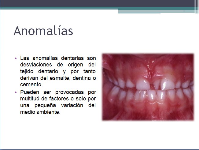 DENTAL 1001 UNAM: Macro y Microdoncia, y otras Anomalías Dentales ...