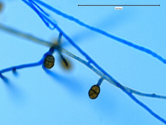Fun With Microbiology (What's Buggin' You?): Stemphylium species