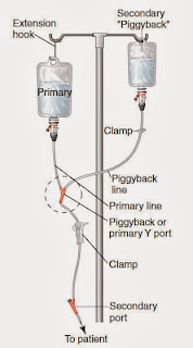 Administering Medication by Intermittent Infusion (Piggyback Set) ~ Nursing