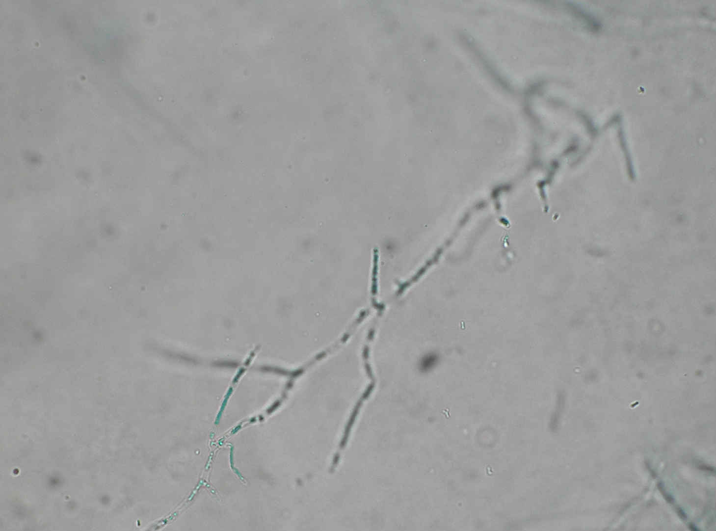 ATLAS MICOLOGIA: TRICHOPHYTON SOUDANENSE