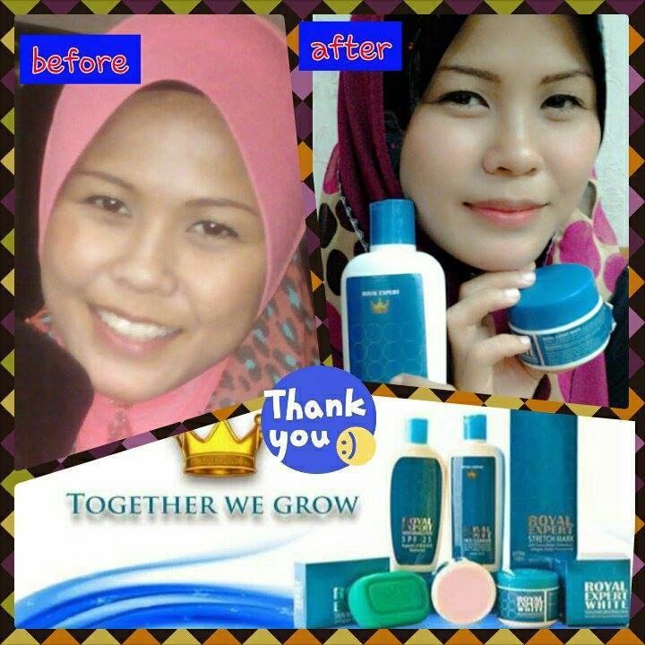 ROYAL EXPERT WHITENING CREAM MURAH ORIGINAL | Harga Murah Original ...