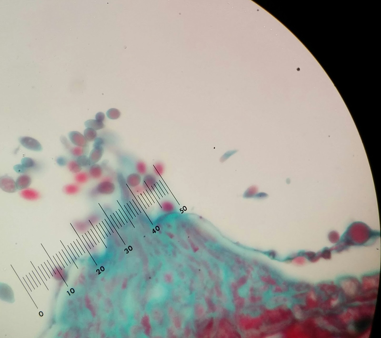 Fungal Plant Pathology: October 2015