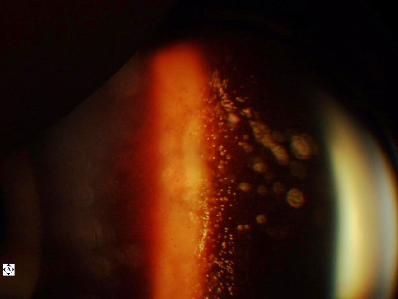 Sonoran Desert Eye Center: July 2014