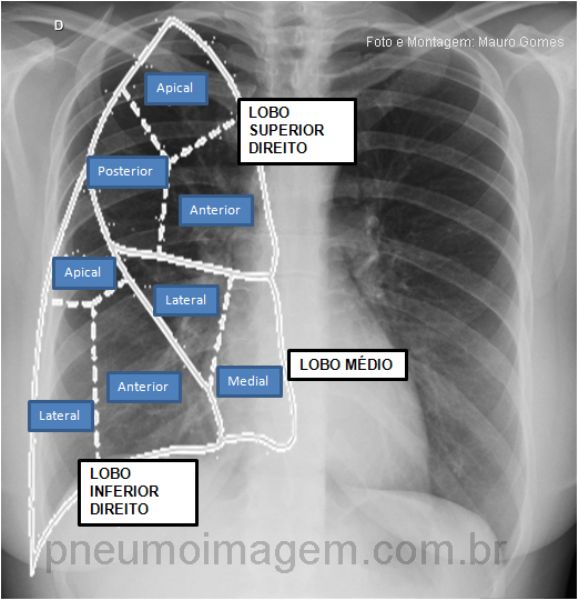 SALUDUCEBOL2011: ANATOMIA RADIOLOGICA