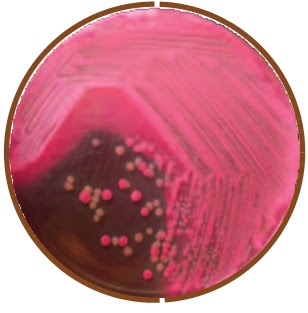 [Microbiology] Desoxycholate Agar | Free Medical Atlas