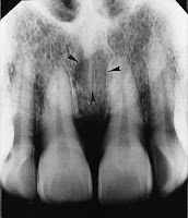 Dental Student Study Guide: Intra oral Radiographic Landmarks