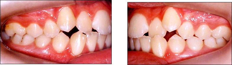 Curso de Ortodontia APCD Pinheiros