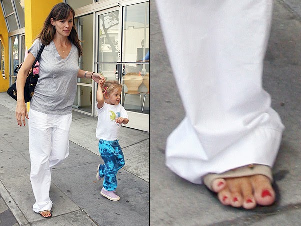 ListasDe10.com: 5 Famosas con Defectos Fisicos