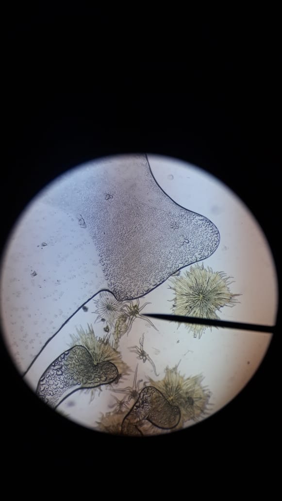 Trikoma pada Daun Durian