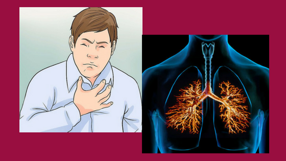 Bronchitis (Acute) Symptoms, Causes, Treatment, and Cures: