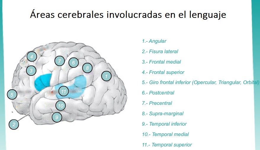 LATERALIZACIÓN, LENGUAJE Y CEREBRO ESCINDIDO