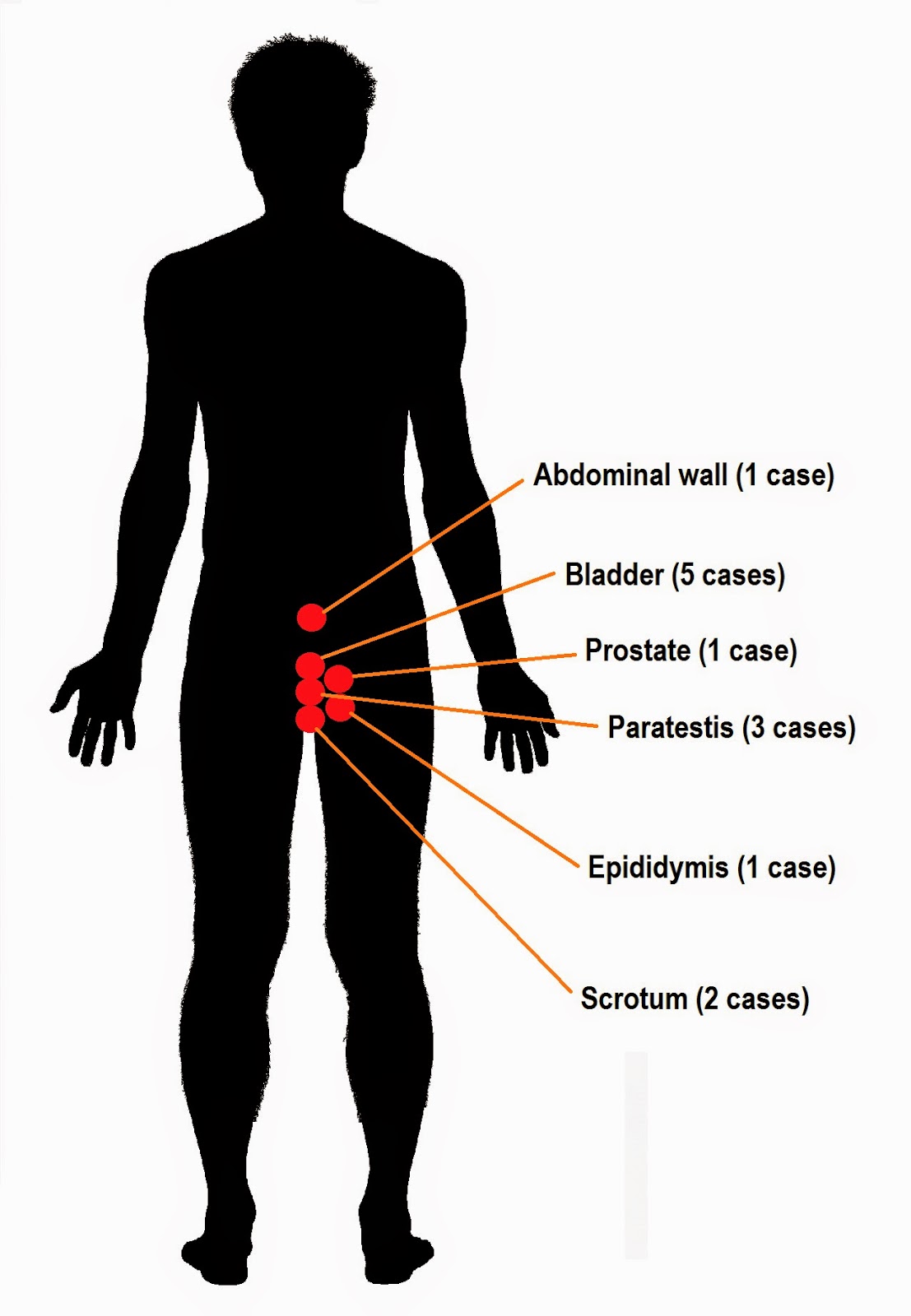 Endometriosis Update: Endometriosis Awareness Month – Part I
