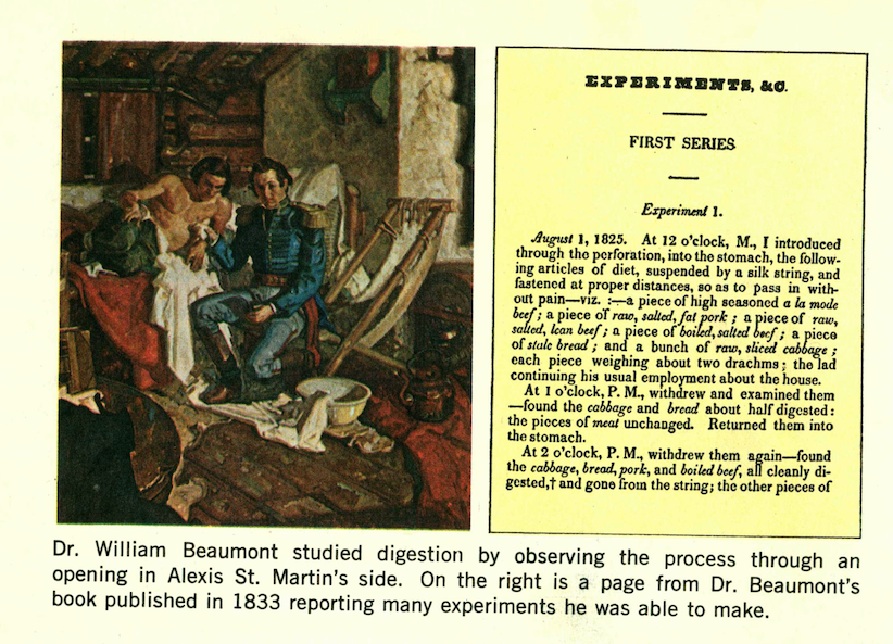 Noli insipientium iniurias pati: Dr. William Beaumont sticking random ...