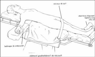 POSICIONES QUIRURGICAS: POSICIÓN TRENDELENBURG INVERTIDO