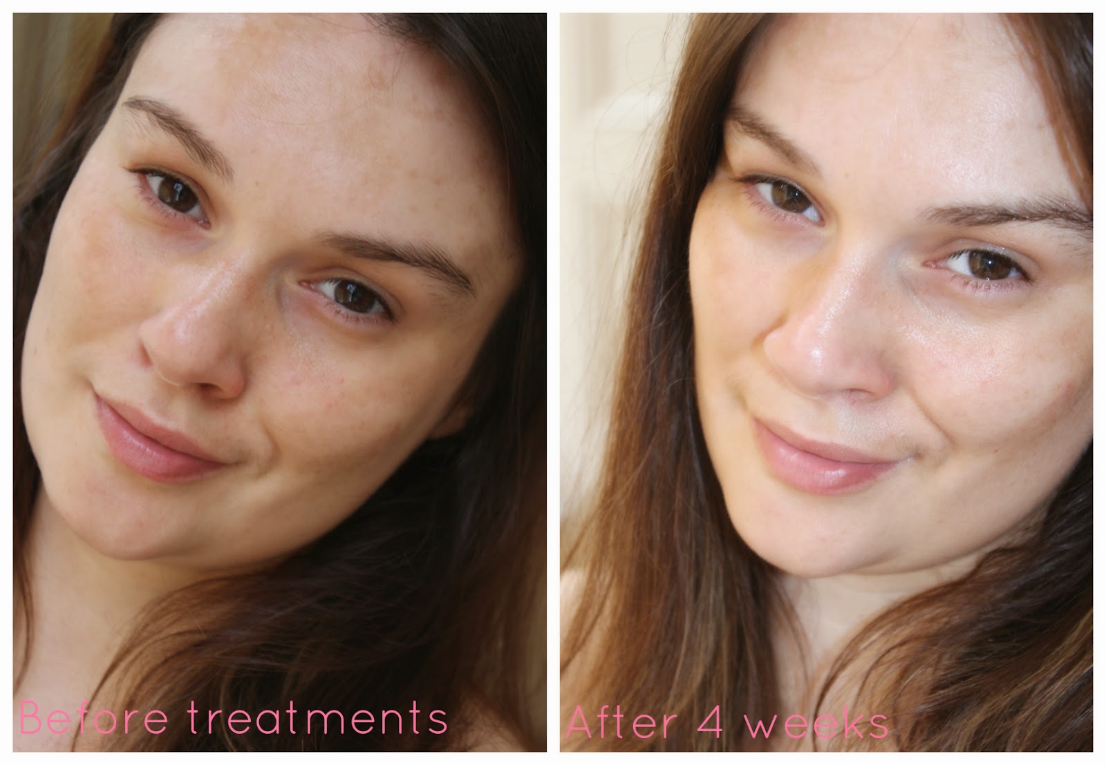 beautiful me plus you: Neostrata Glycolic Treatment Peel - Review