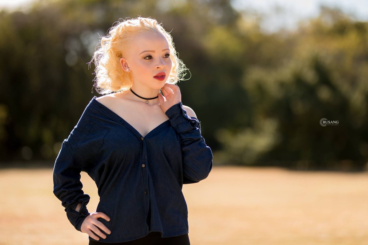Meet Mokoena-South African albino Model . - ZongoPlus