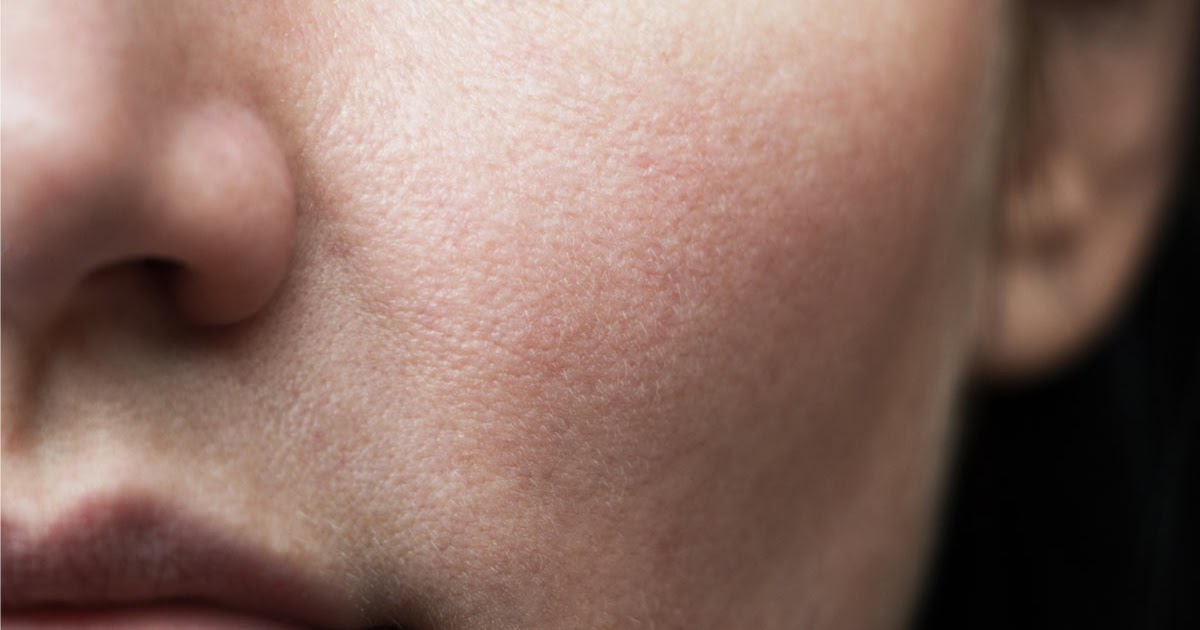 Pores-Causes and Home Treatment | The Health And Skincare