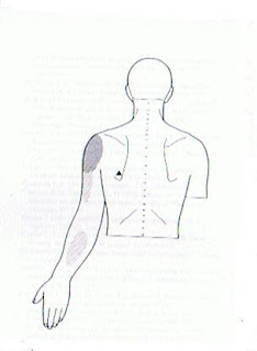 Acupoint: Trigger points for relief