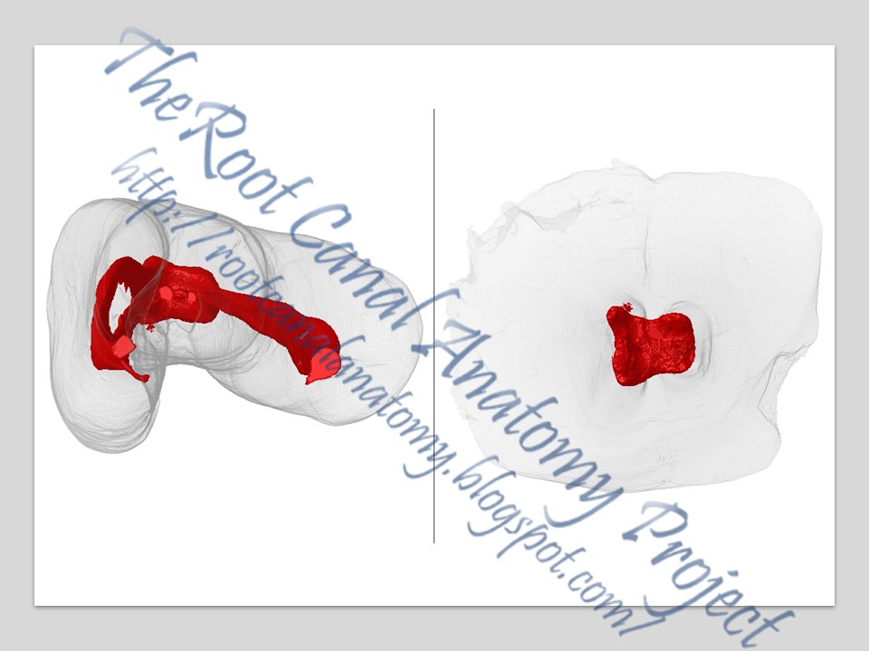 The Root Canal Anatomy Project: Mandibular First Molar